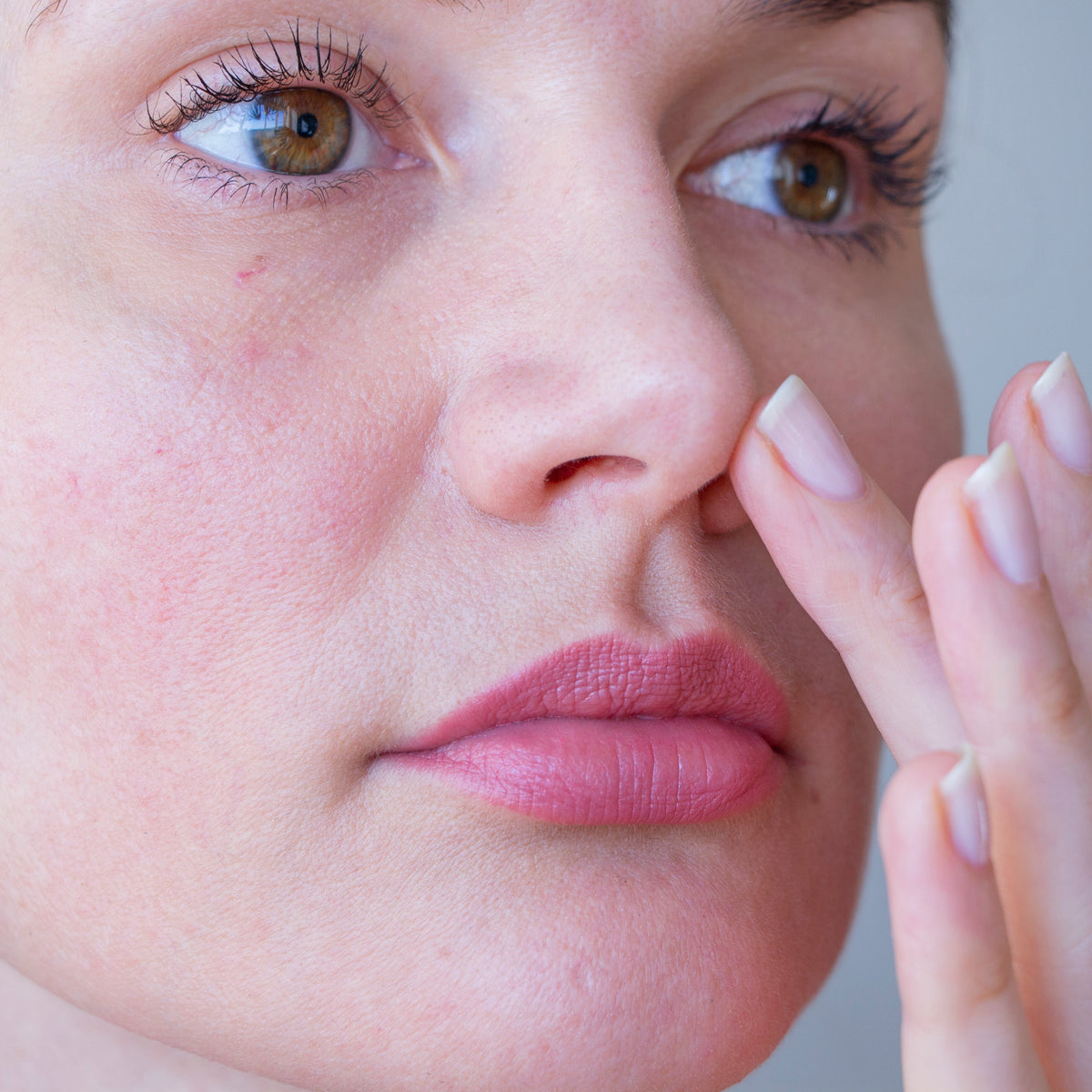 Understanding Rosacea and How to Treat it – Embassy of Beauty